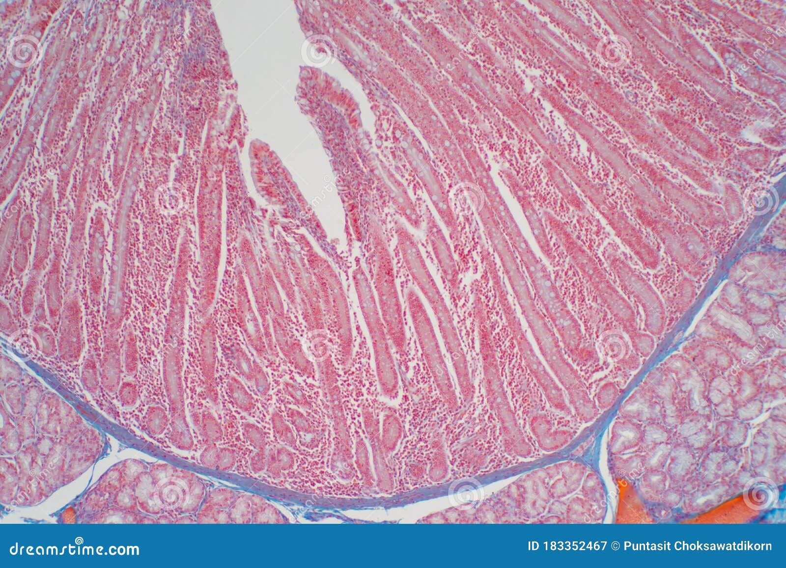 Duodenum Slide Labeled