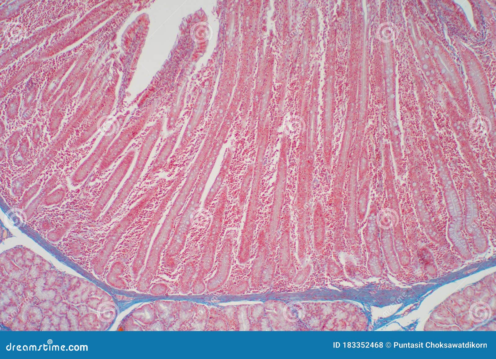 Human Duodenum Histology