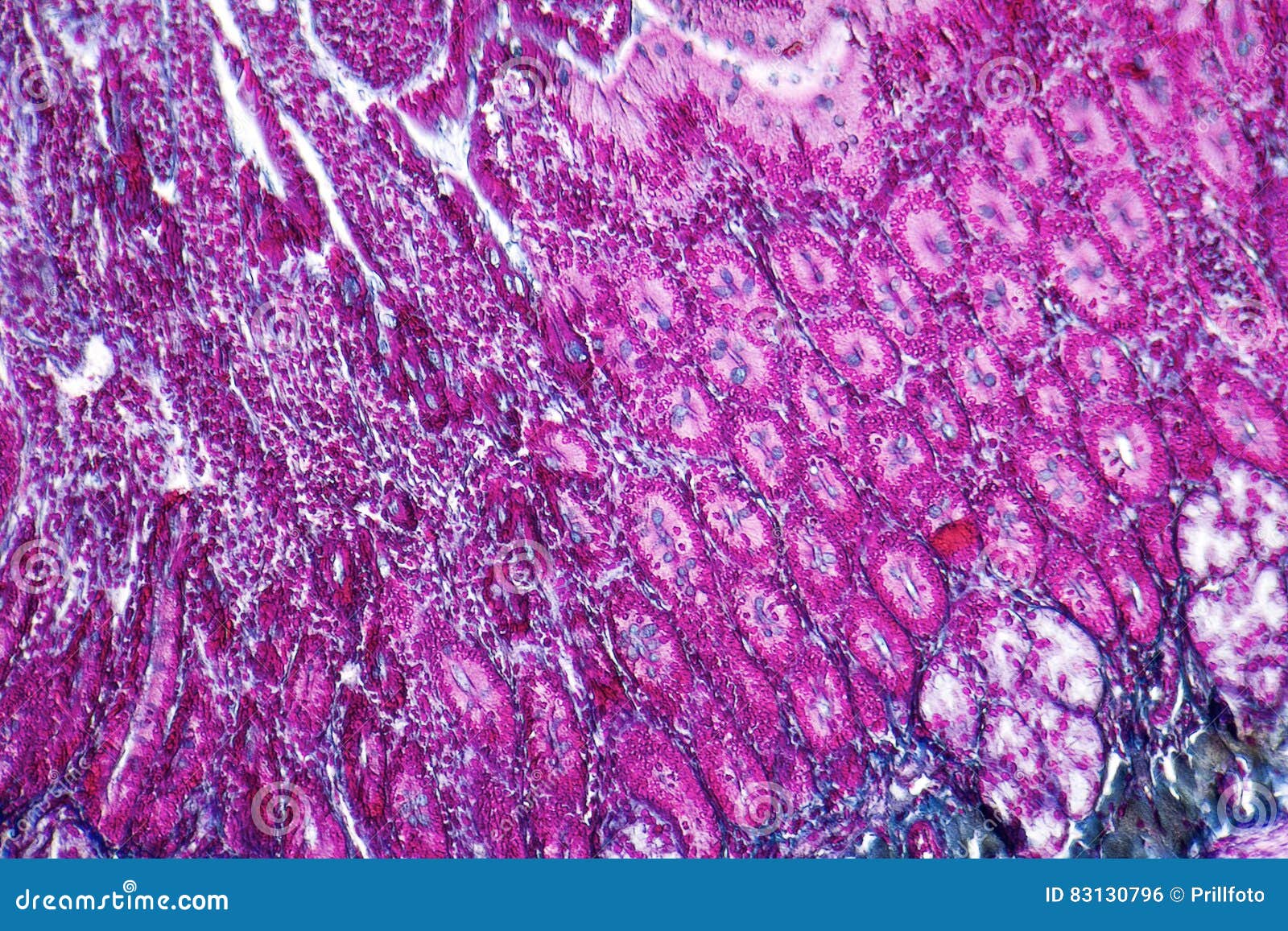 Duodenum cross section stock photo. Image of intestine - 83130796