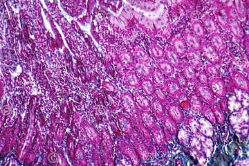 Duodenum cross section stock photo. Image of intestine - 83130796