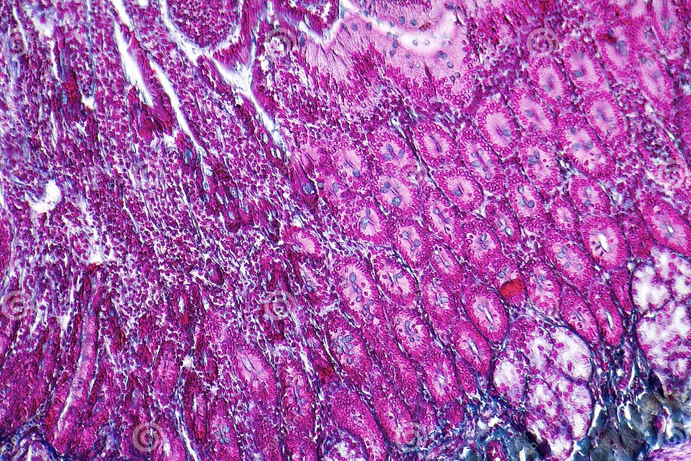 Duodenum cross section stock photo. Image of intestine - 83130796