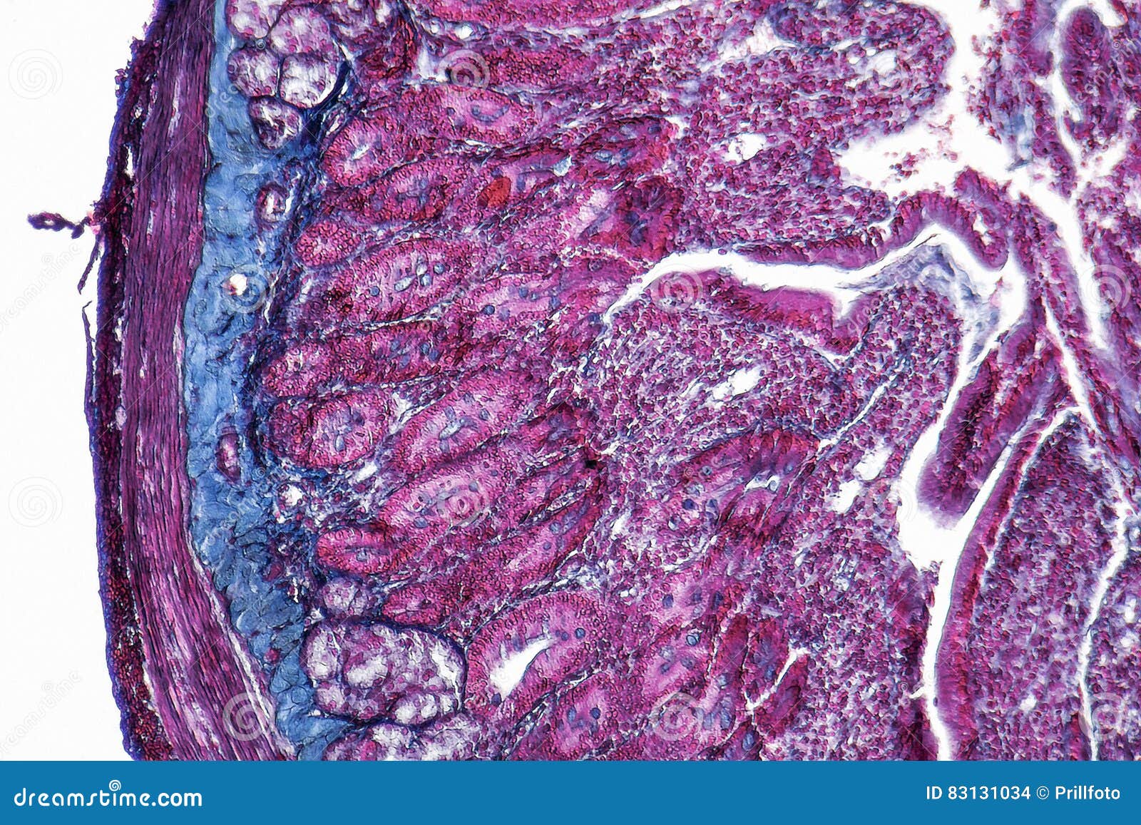 Duodenum cross section stock photo. Image of medicine - 83131034