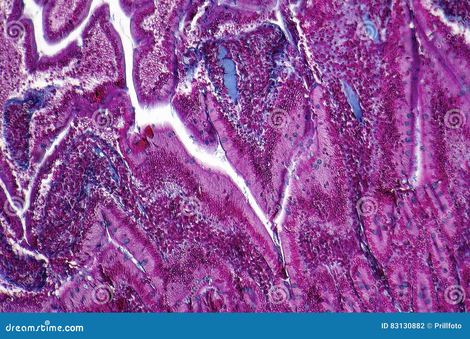 Duodenum cross section stock photo. Image of medicine - 83130882