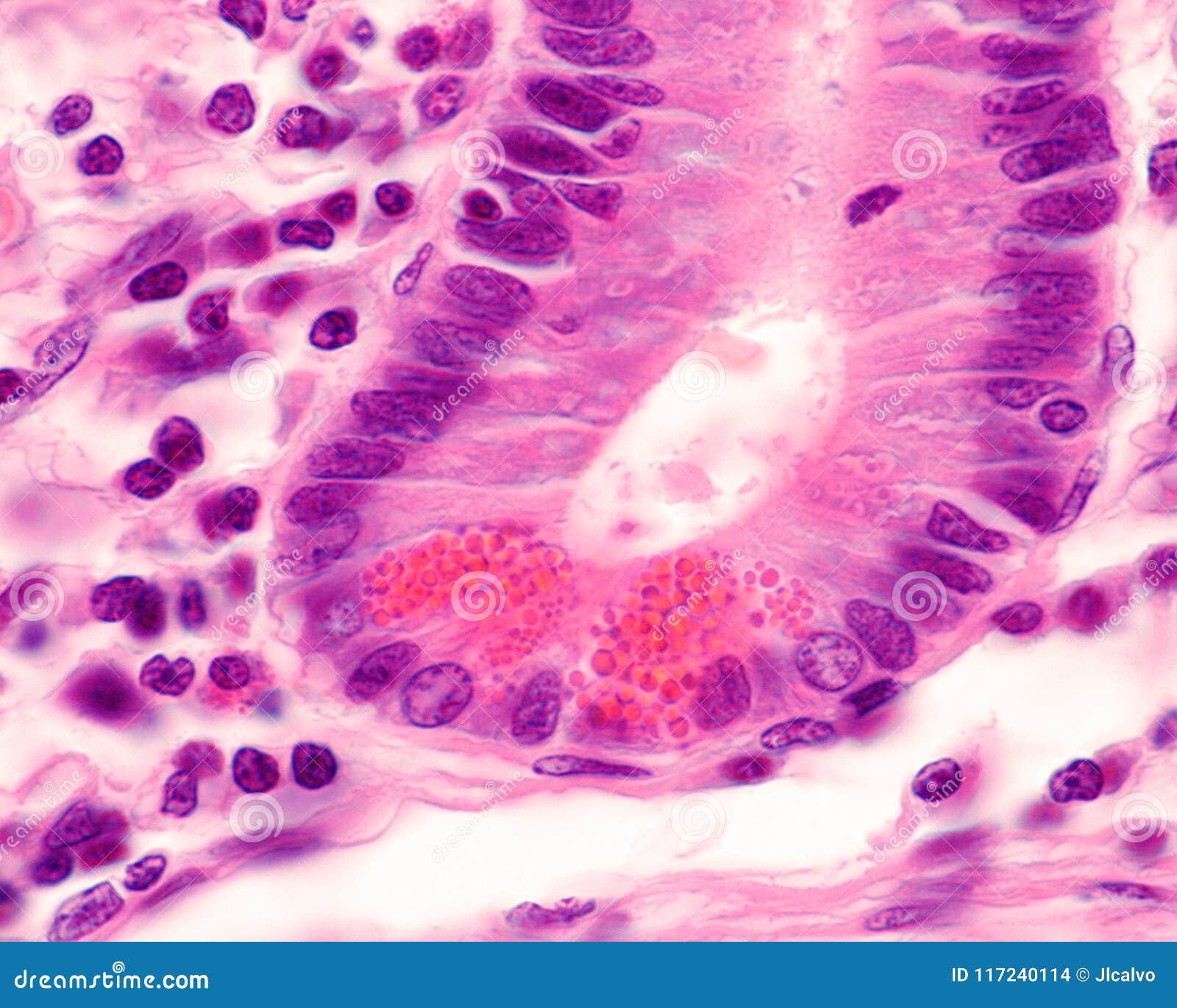Duodenum. Paneth cells stock photo. Image of small, digestive - 117240114
