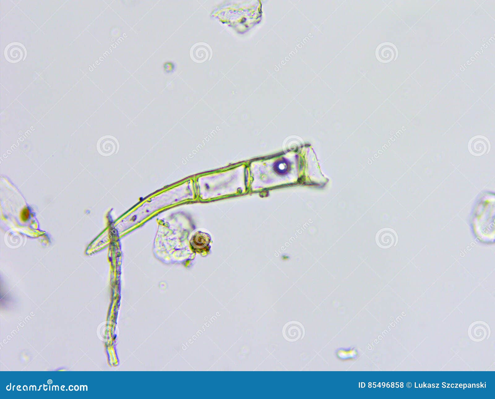 Dust and Microorganisms Microscopic View Stock Photo - Image of ...