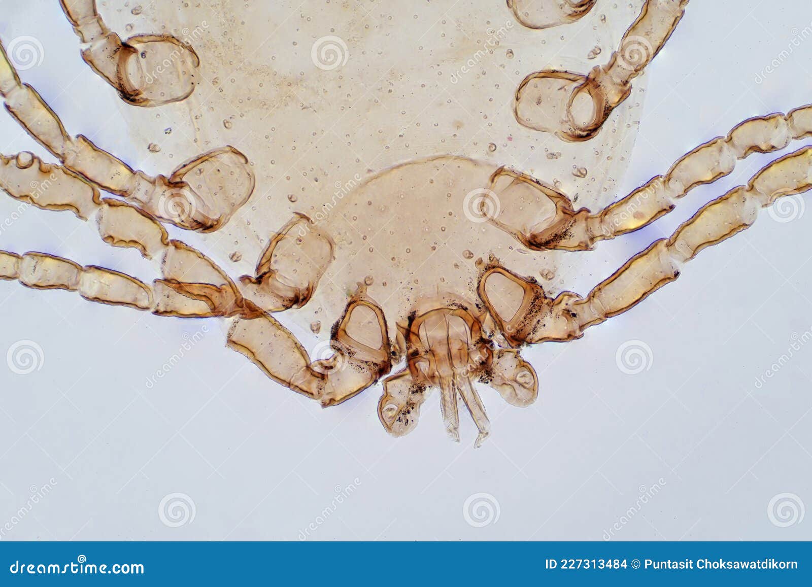 Dust Mite Under Light Microscope View Stock Photo - Image of hygiene ...