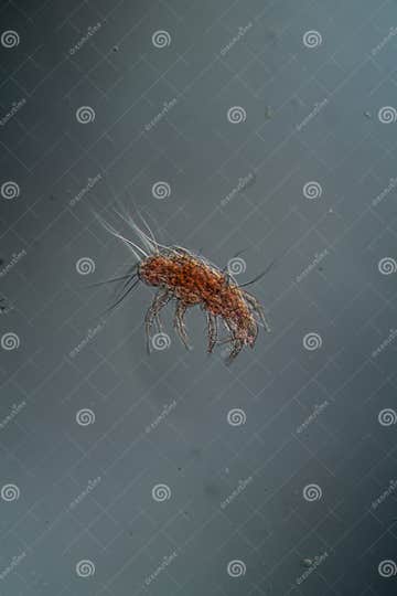 Dust Mites Under the Microscope Stock Image - Image of magnification ...