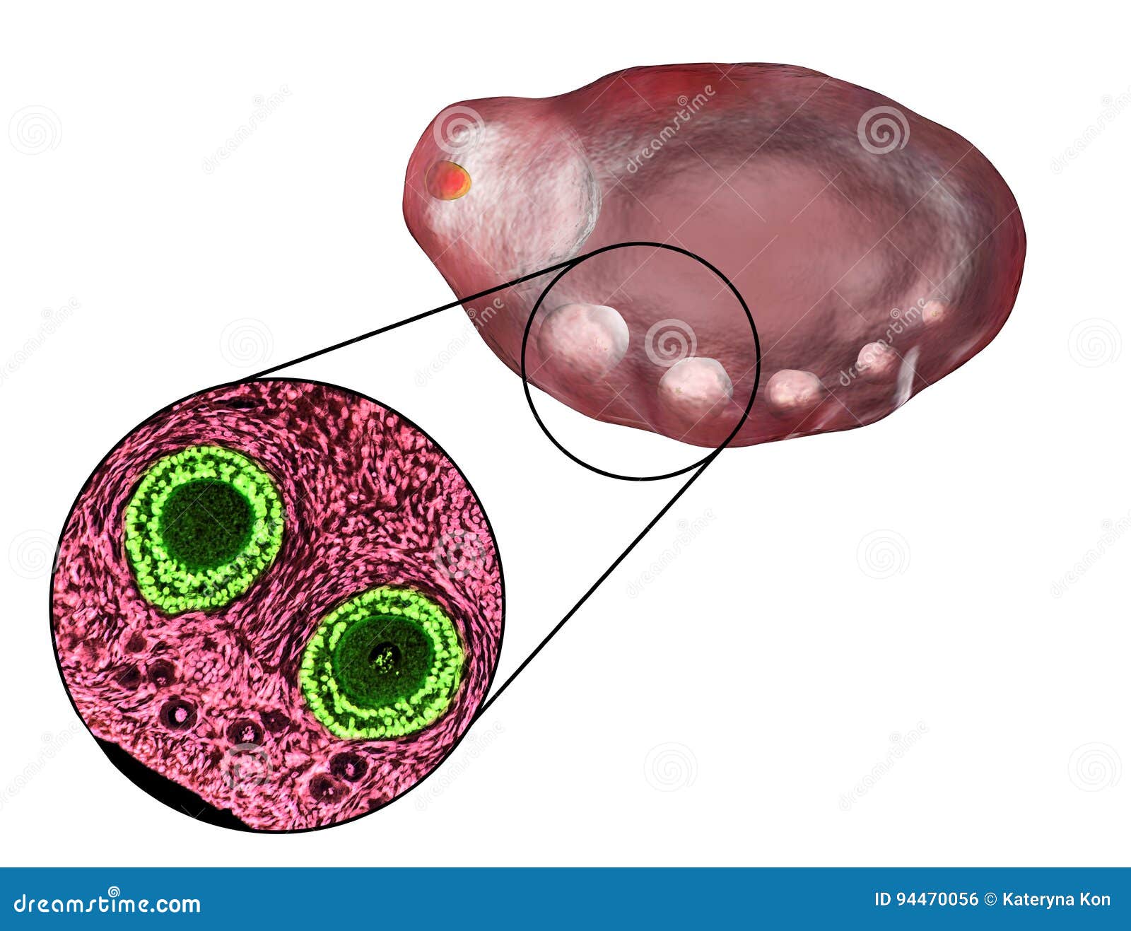 In Dwarsdoorsnede Van Een Eierstok Stock Illustratie - Illustration of ...