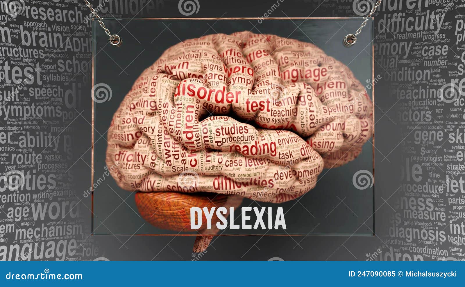 Dyslexia in human brain stock illustration. Illustration of ideas ...