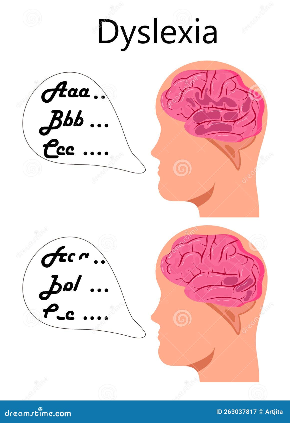 Dyslixia Concept Vector. Problems with Speech and Writing in Dyslexic Stock Vector ...