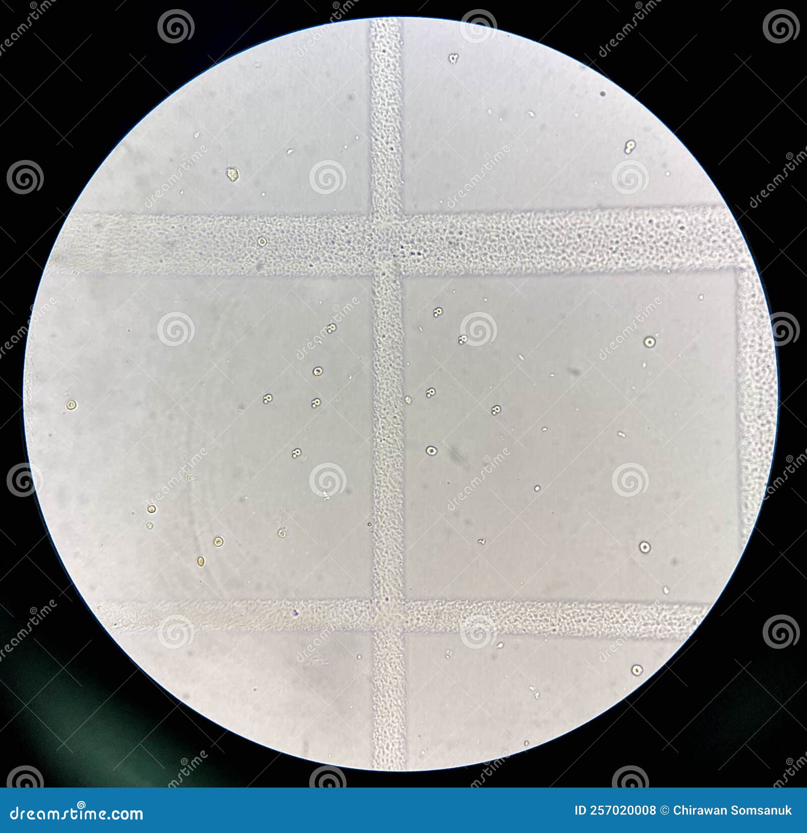 Dysmorphic Urinary RBCs Have Been Regarded As an Indicator of ...