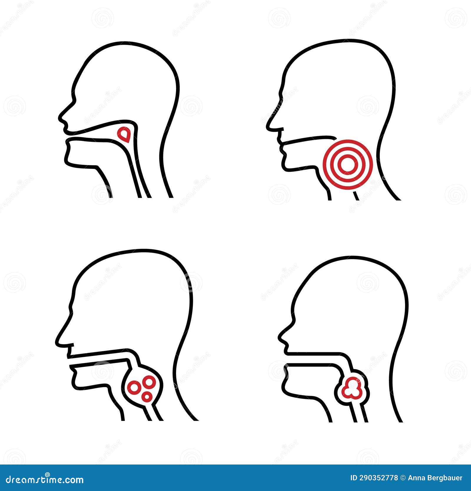 Dysphagia Linear Icon. Aphagia Line Pictogram. Difficulty in Swallowing ... Dysphagia Linear Icon. Aphagia Line Pictogram. Difficulty in Swallowing ...