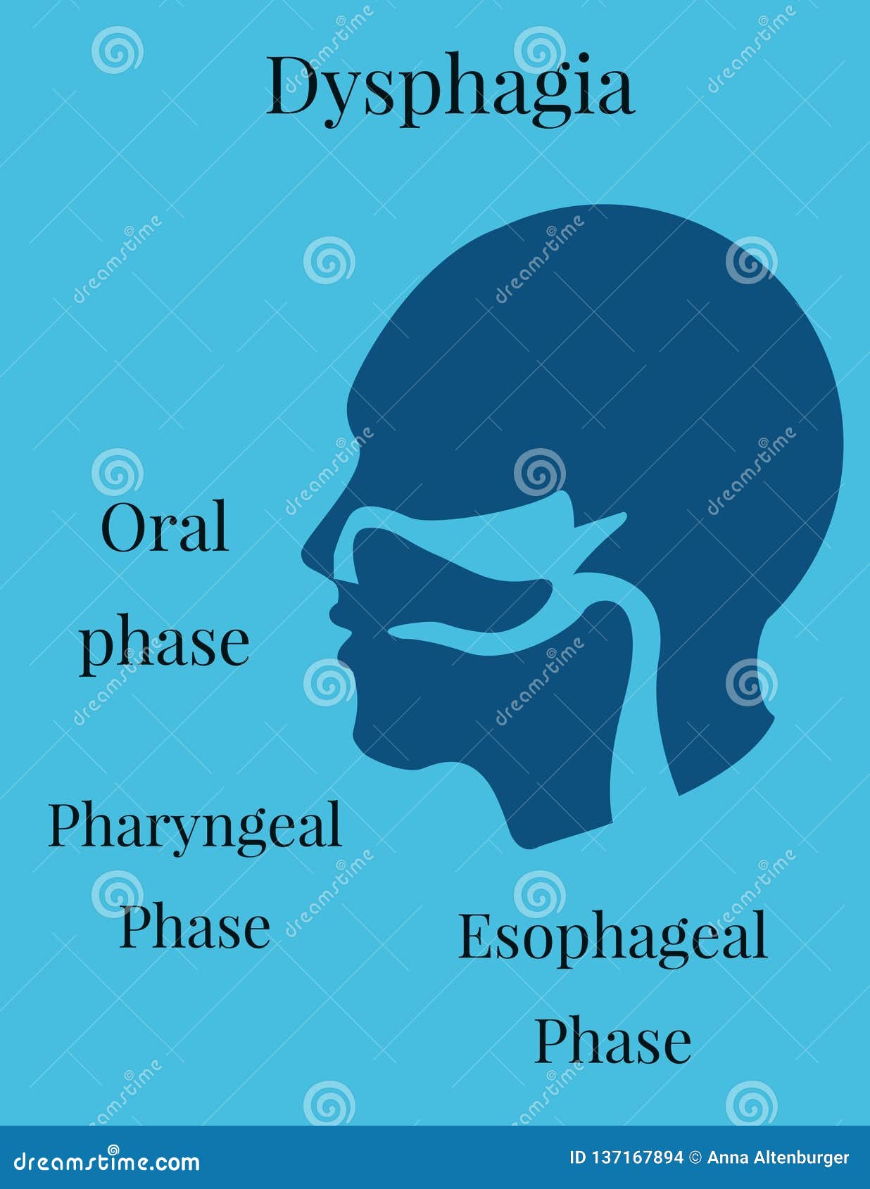 Dysphagia and Speech Therapy Stock Illustration - Illustration of ...