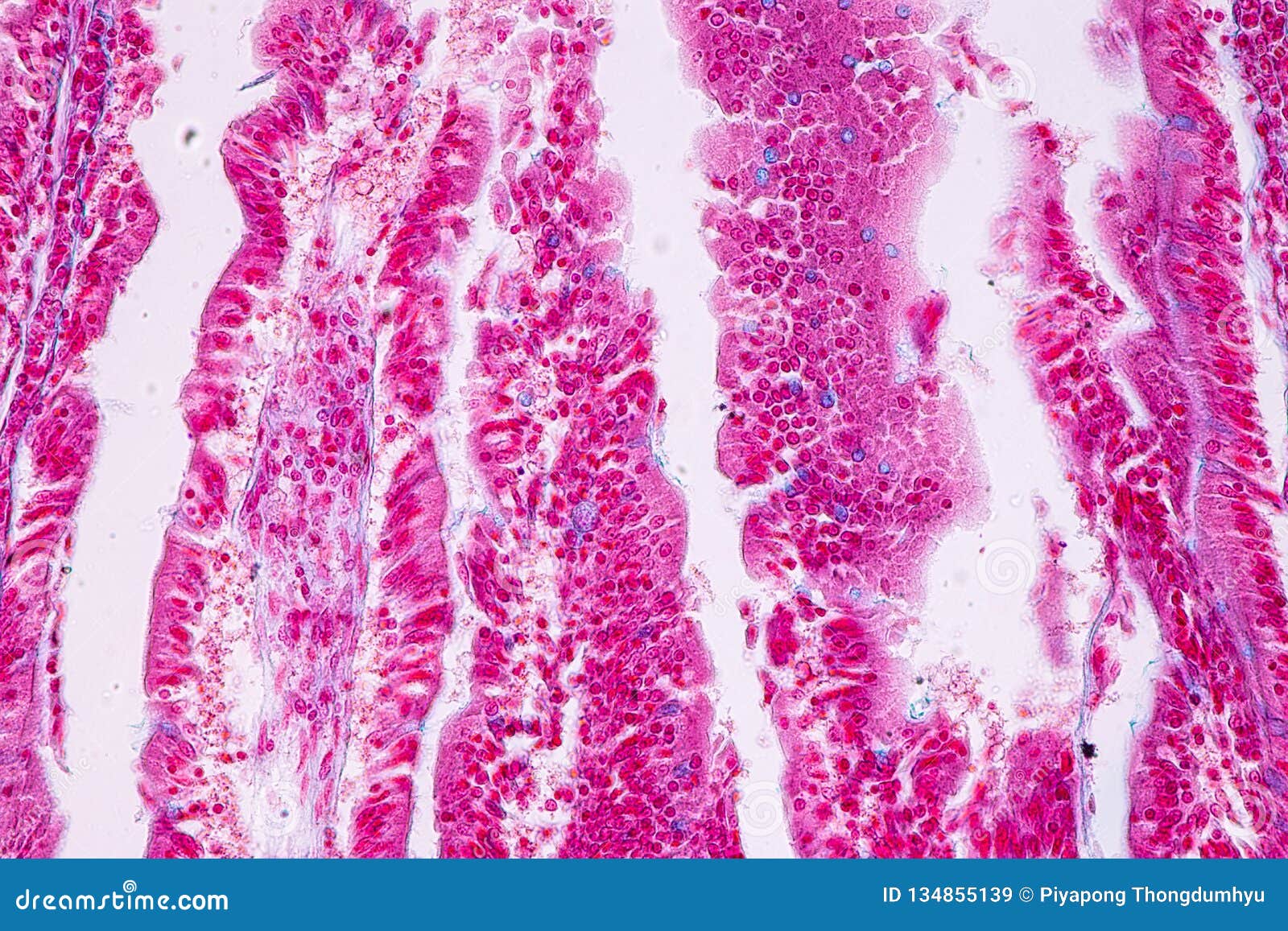 Tissue of Small Intestine or Small Bowel Under the Microscopic ...