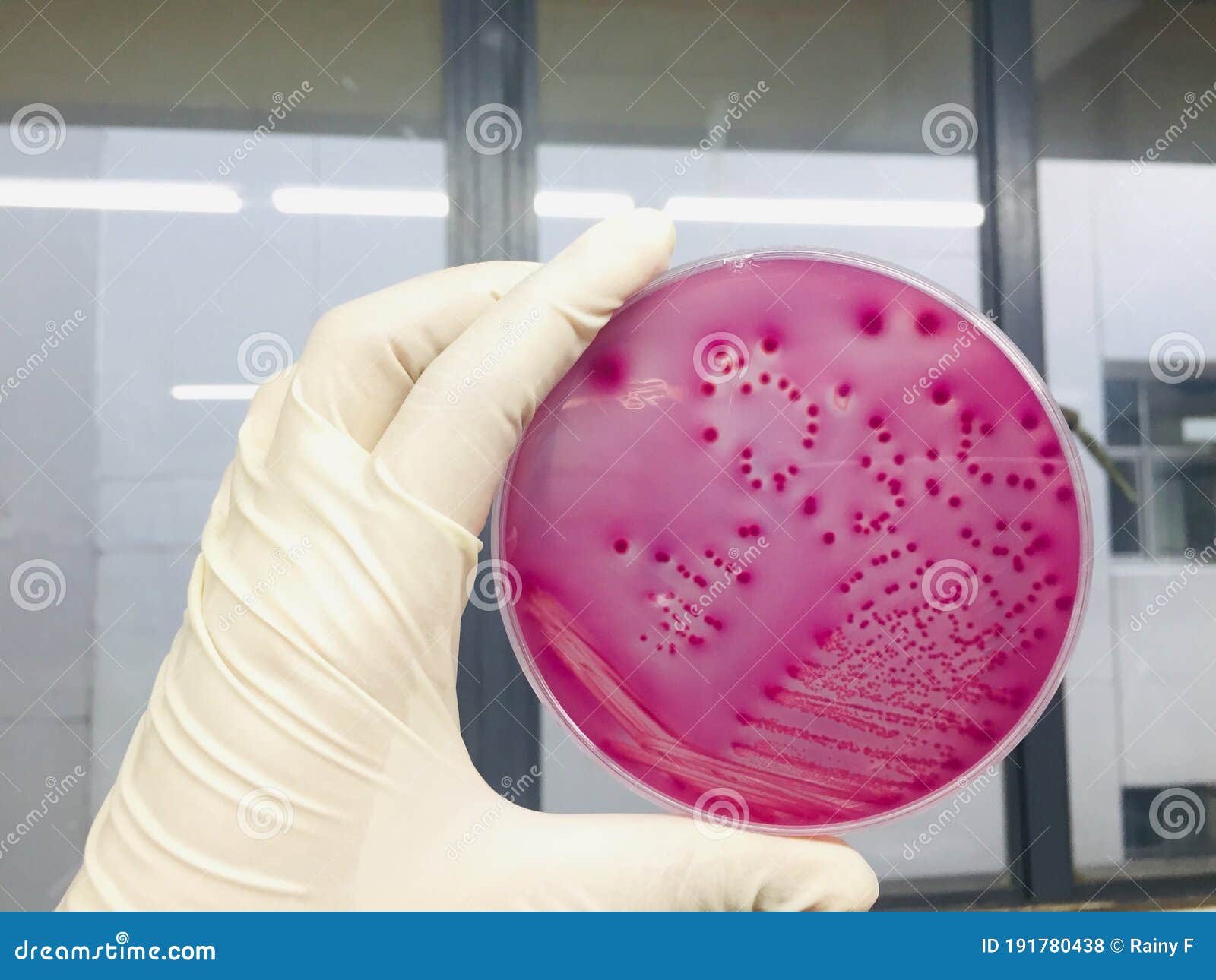 E.coli On EMB Agar Plate Royalty-Free Stock Photography | CartoonDealer ...