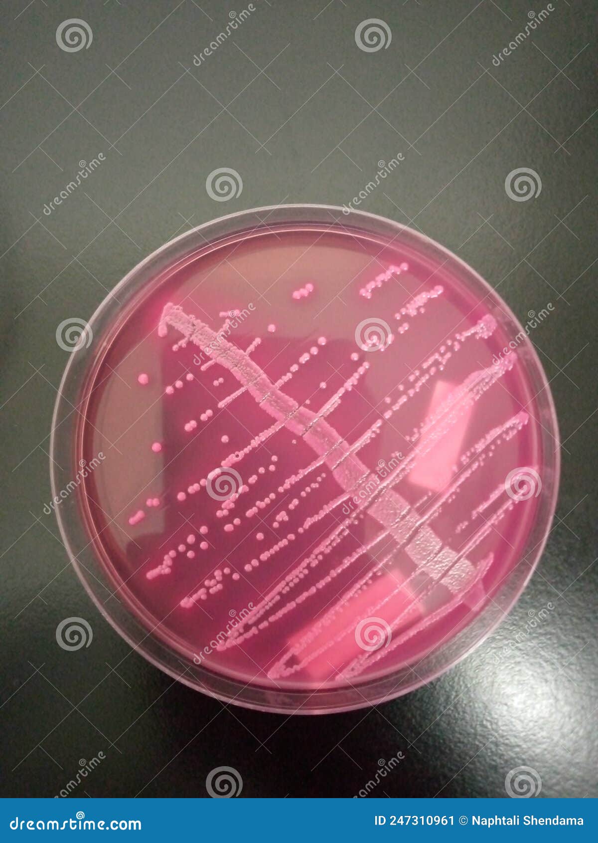 E. Coli Bacteria on Culture Medium Stock Image - Image of lighting ...