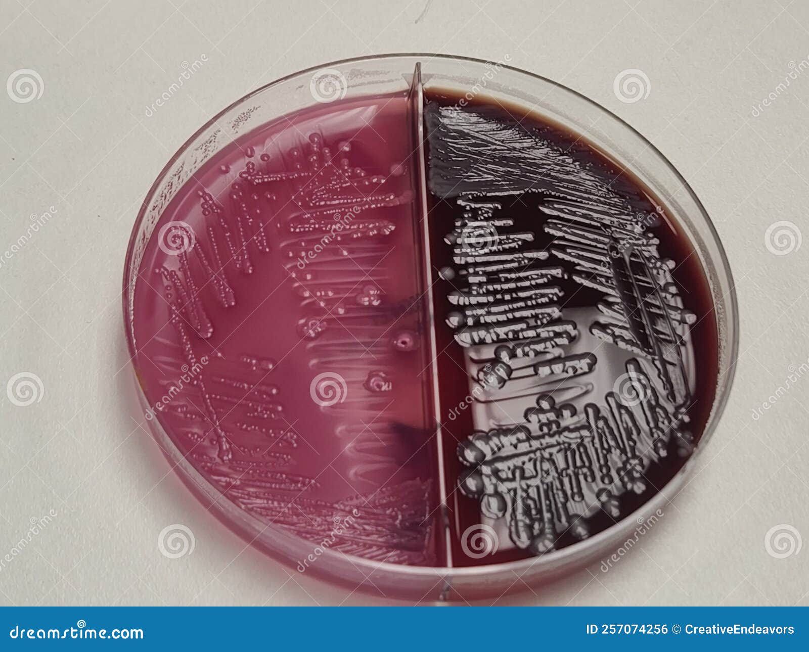 E. Coli Bacteria Growing On Blood And Macconkey Agar Stock Photography ... E. Coli Bacteria Growing On Blood And Macconkey Agar Stock Photography ...