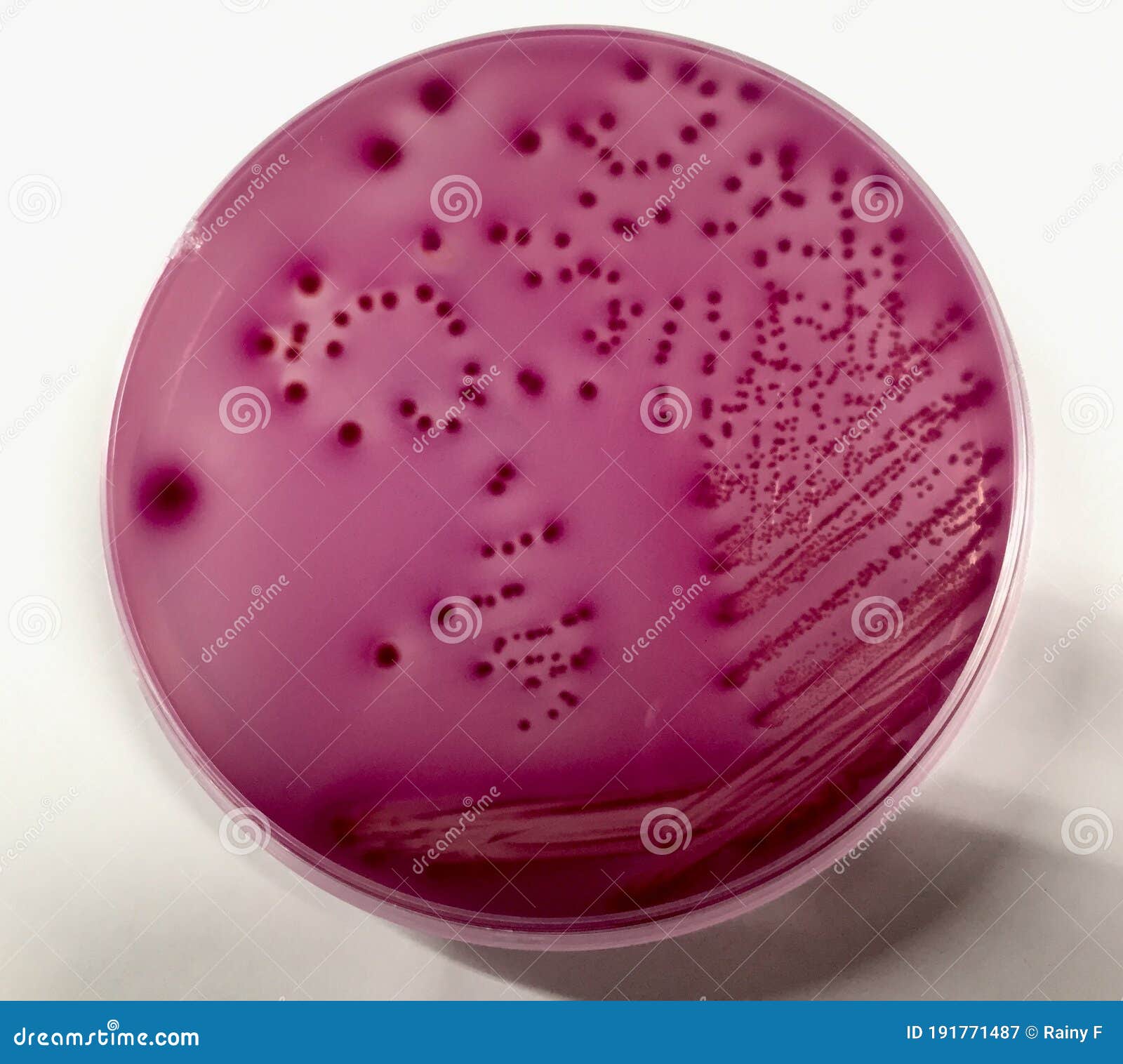 E. Coli Bacteria Growing On The Plate Royalty-Free Stock Image ... E. Coli Bacteria Growing On The Plate Royalty-Free Stock Image ...