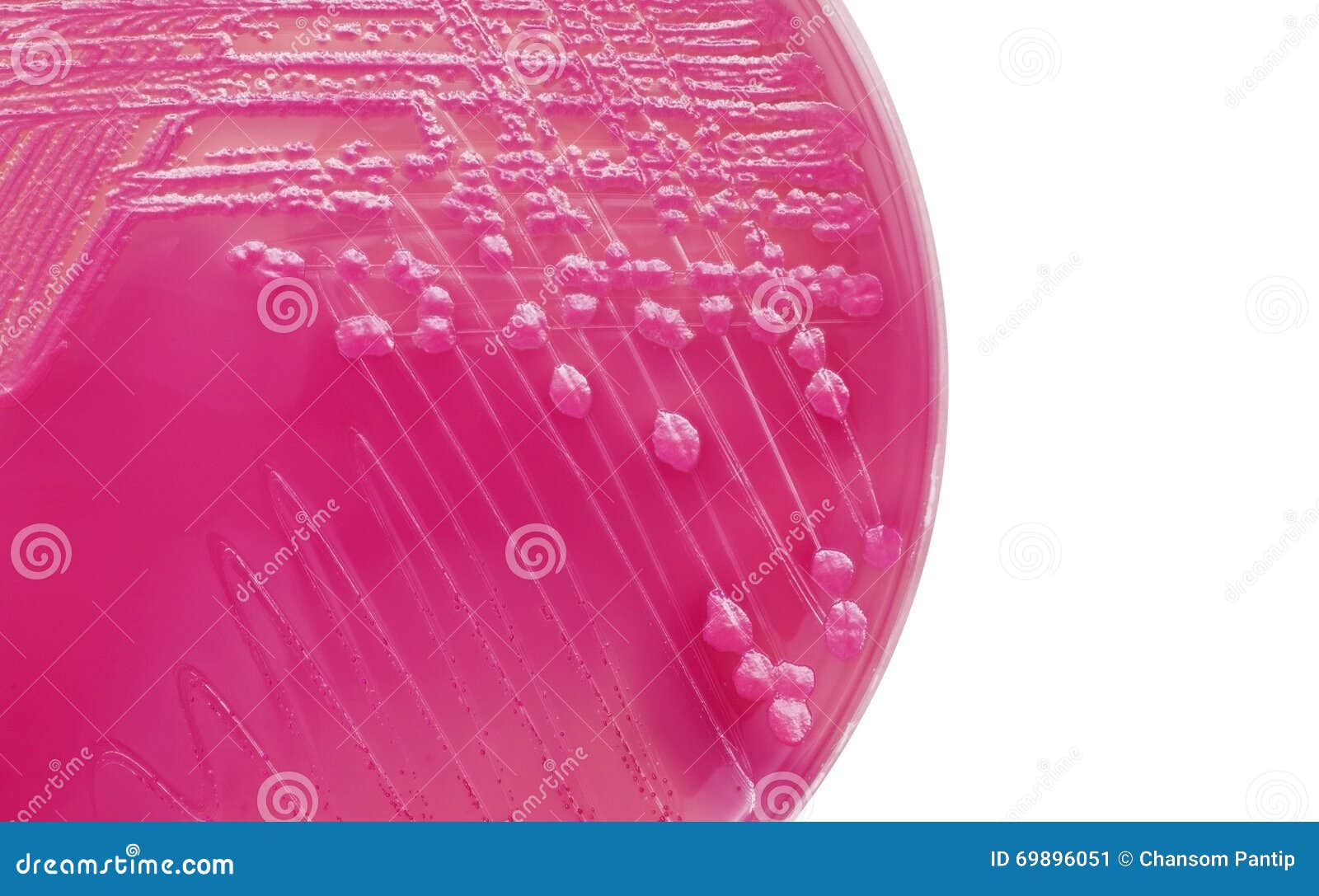 Bacterial Pathogen Colony On An Agar Streak Plate In A Medical ...