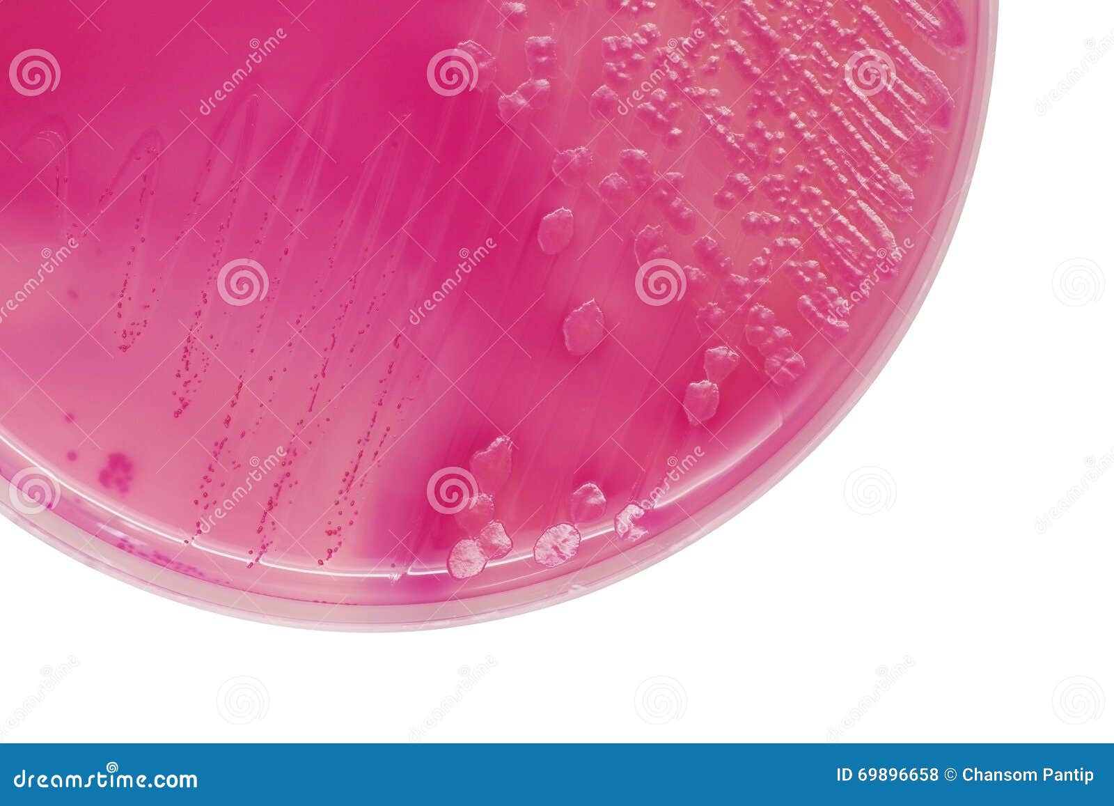 E.coli Bacterial Colonies on MacConkey Agar Plate Stock Photo - Image ...