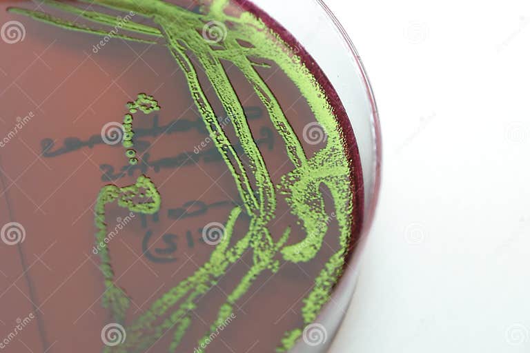 E. coli on EMB agar stock image. Image of scientific, microbe - 2055821