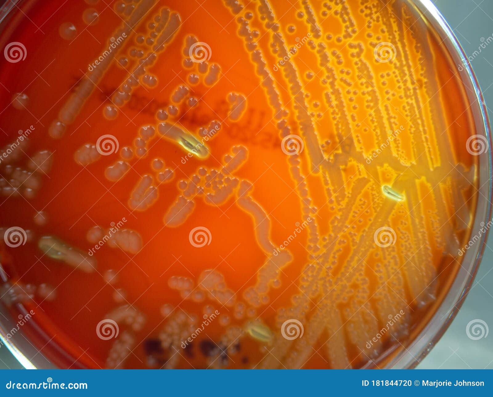 E. Coli with Hemolysis on Blood Agar Stock Photo - Image of hospital ... E. Coli with Hemolysis on Blood Agar Stock Photo - Image of hospital ...