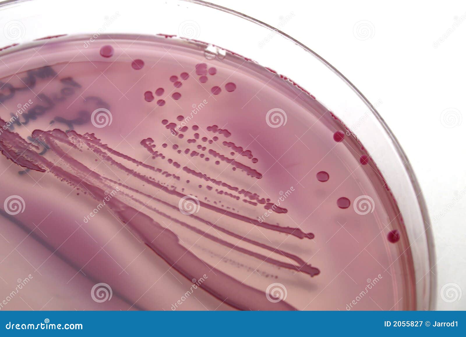 E Coli On Blood Agar