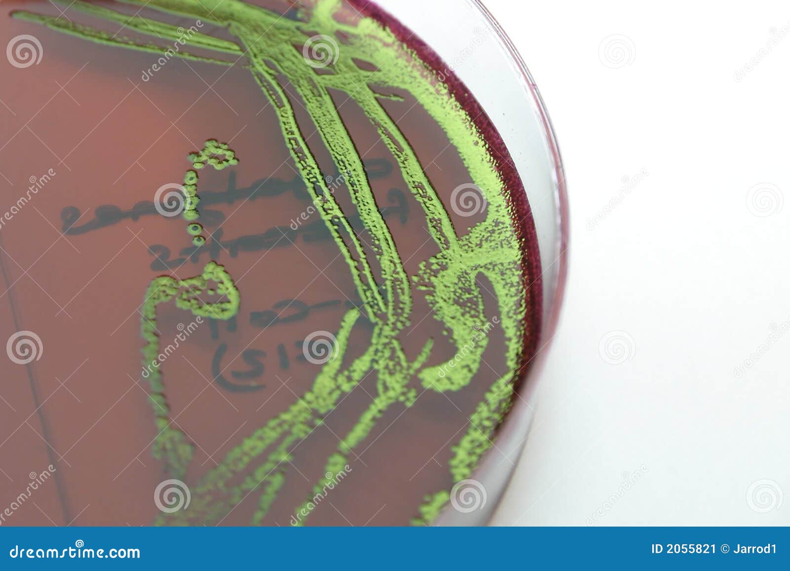 E. coli op agar-agar EMB stock afbeelding. Image of escherichia - 2055821