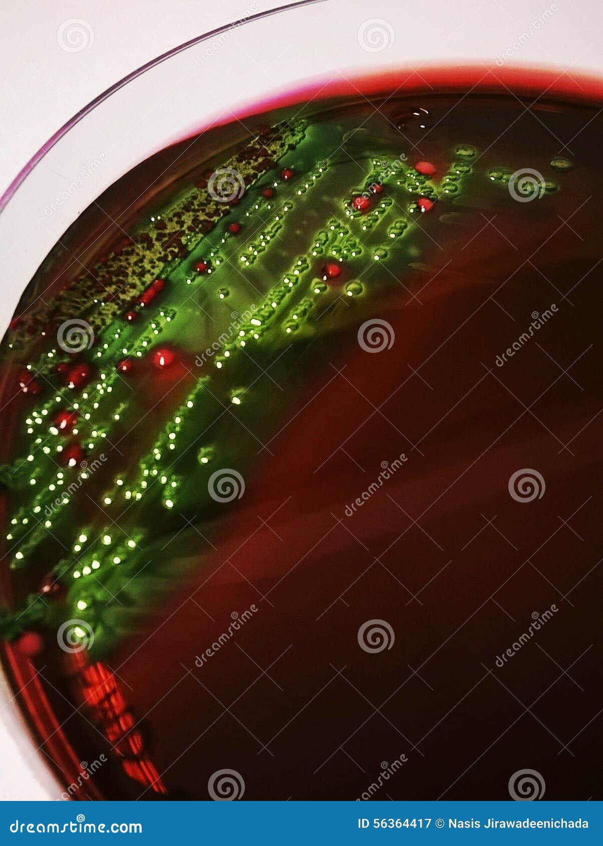 E Escherichia Coli Sull'agar Di EMB Immagine Stock - Immagine di ...