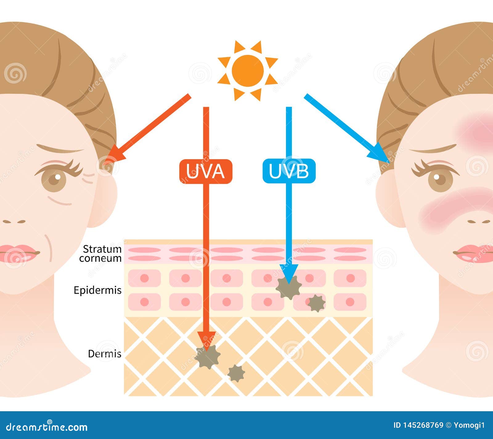 UVA与UVB射线差异的信息图解 紫外线穿透人体皮肤和女性脸部 护肤 向量例证 - 插画 包括有 绘制, 故障: 145268769