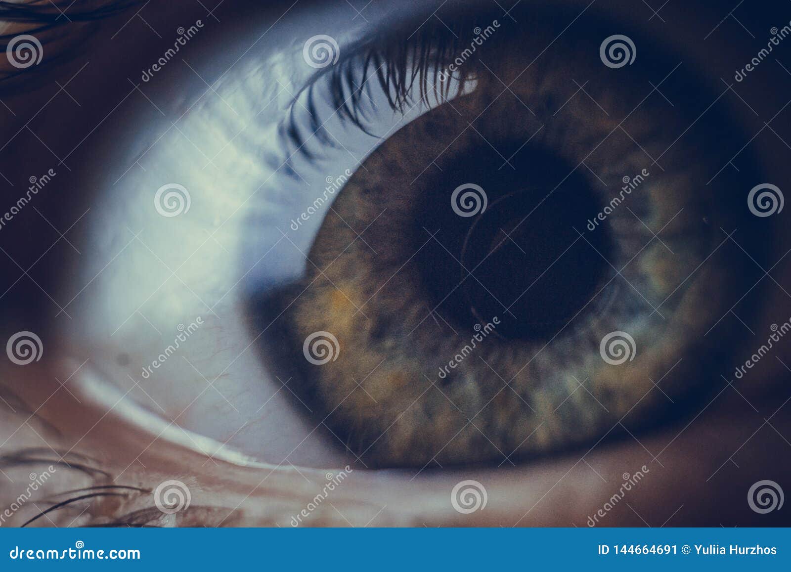 Macro Yeux Avec Des Vaisseaux Sanguins éclatants Oeil Couvert De Sang ...