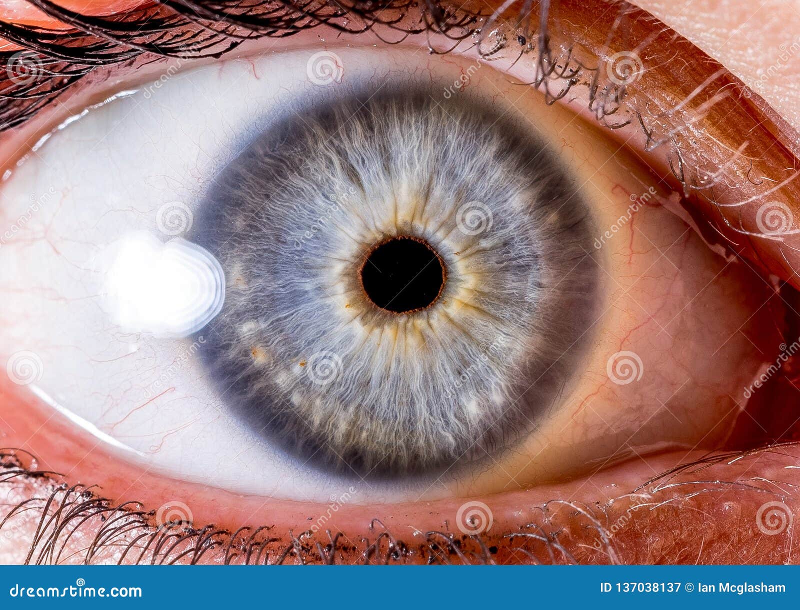 Close Up Eye. Close Up Iris. Very Close Macro Shot of an Eyeball Stock ...