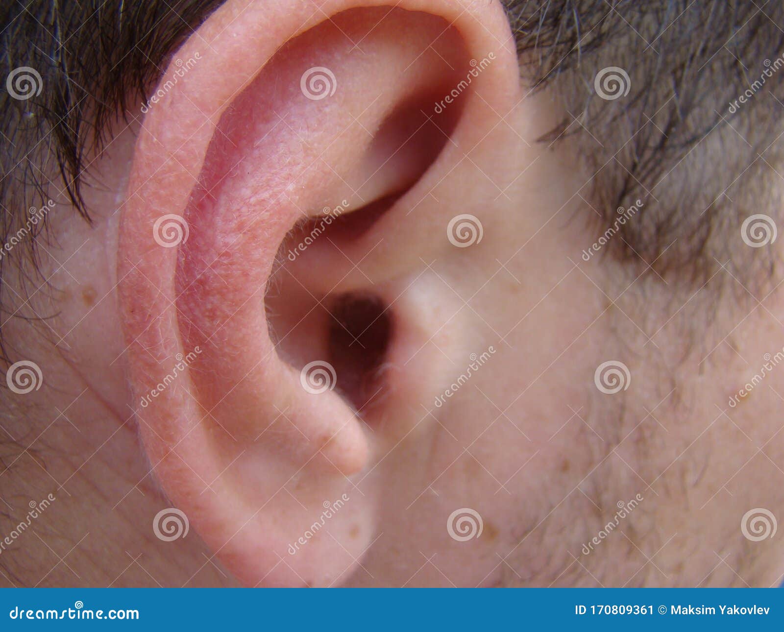 Ear stock image. Image of bone, earwax, organs, lobe - 170809361