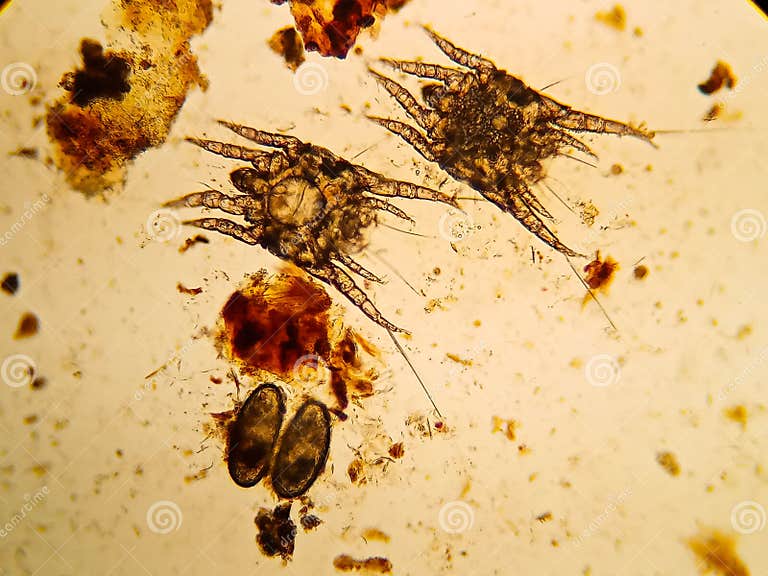 Ear Mite from a Cat, Under the Microscope Stock Photo - Image of ...