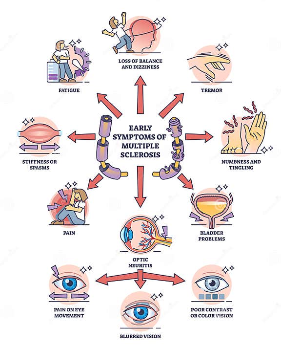 Early Symptoms of Multiple Sclerosis and MS Affected Things Outline ... Early Symptoms of Multiple Sclerosis and MS Affected Things Outline ...
