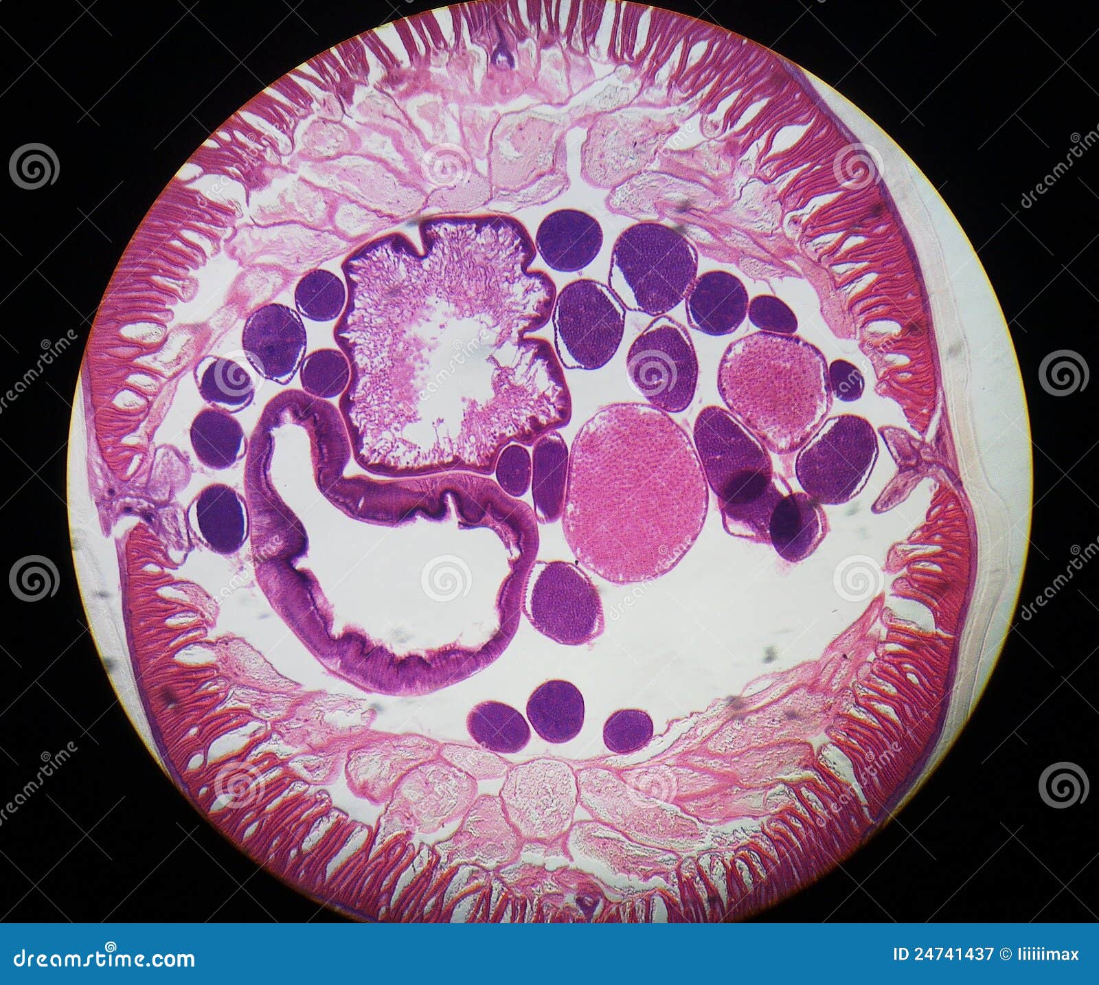 Earthworm Cross Section Segment 10