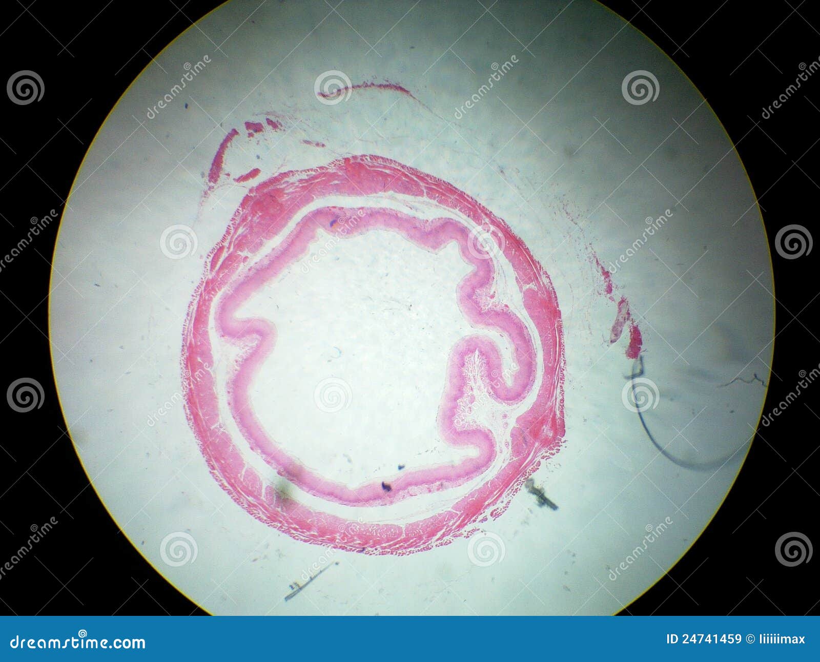 Earthworm Cross Section