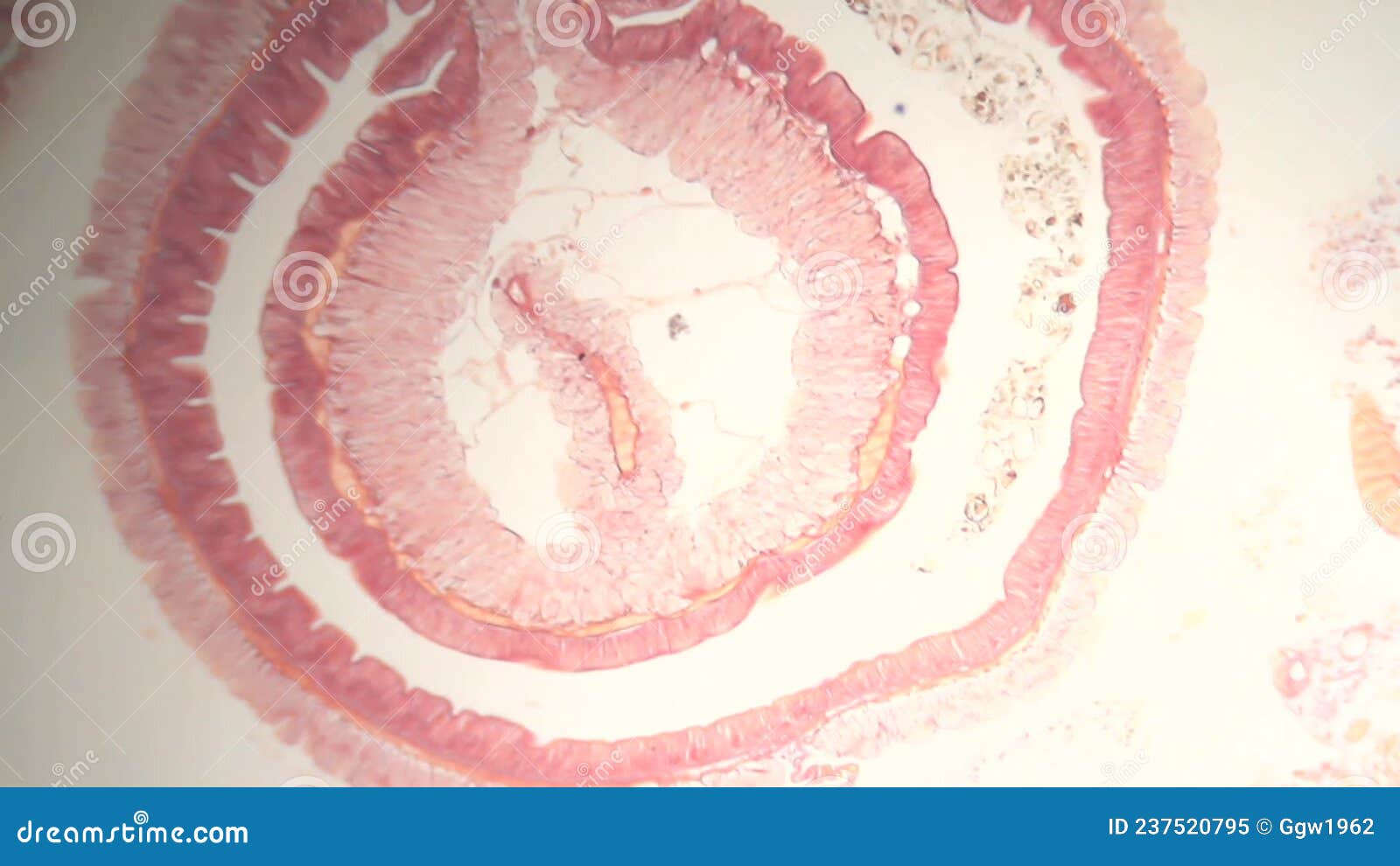 Earthworm Cross Section Earthworm Setae Prepared Microscope Slide