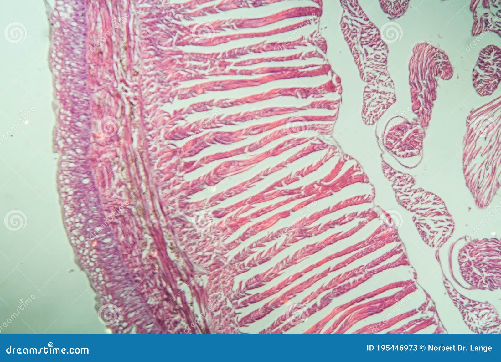 Earthworm Histology Cross Section 10th Segment Stock Image - Image of ...