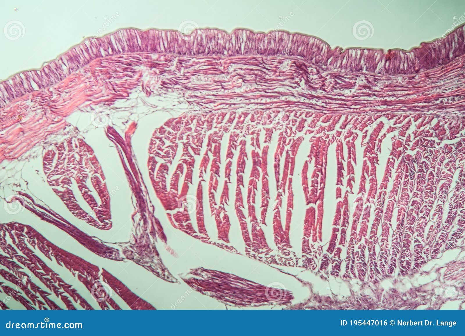 Earthworm Histology Cross Section 10th Segment Stock Photo - Image of ...