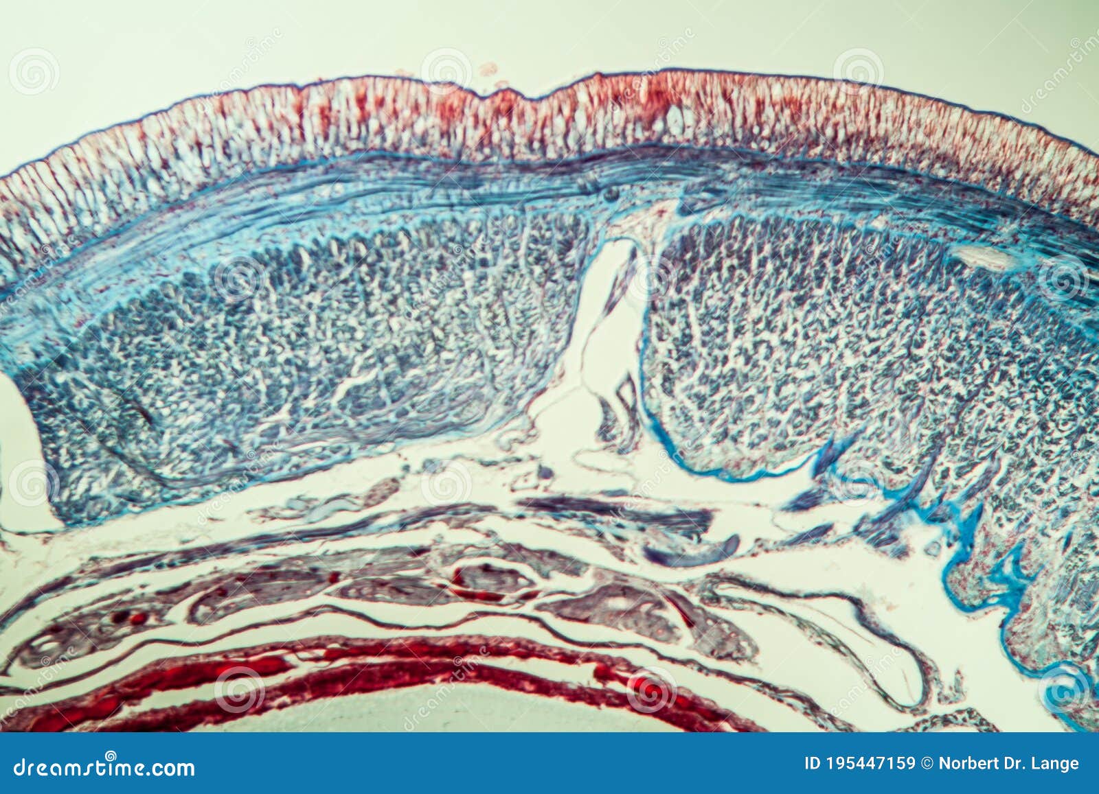 Earthworm Histology Cross Section 10th Segment Stock Image - Image of ...