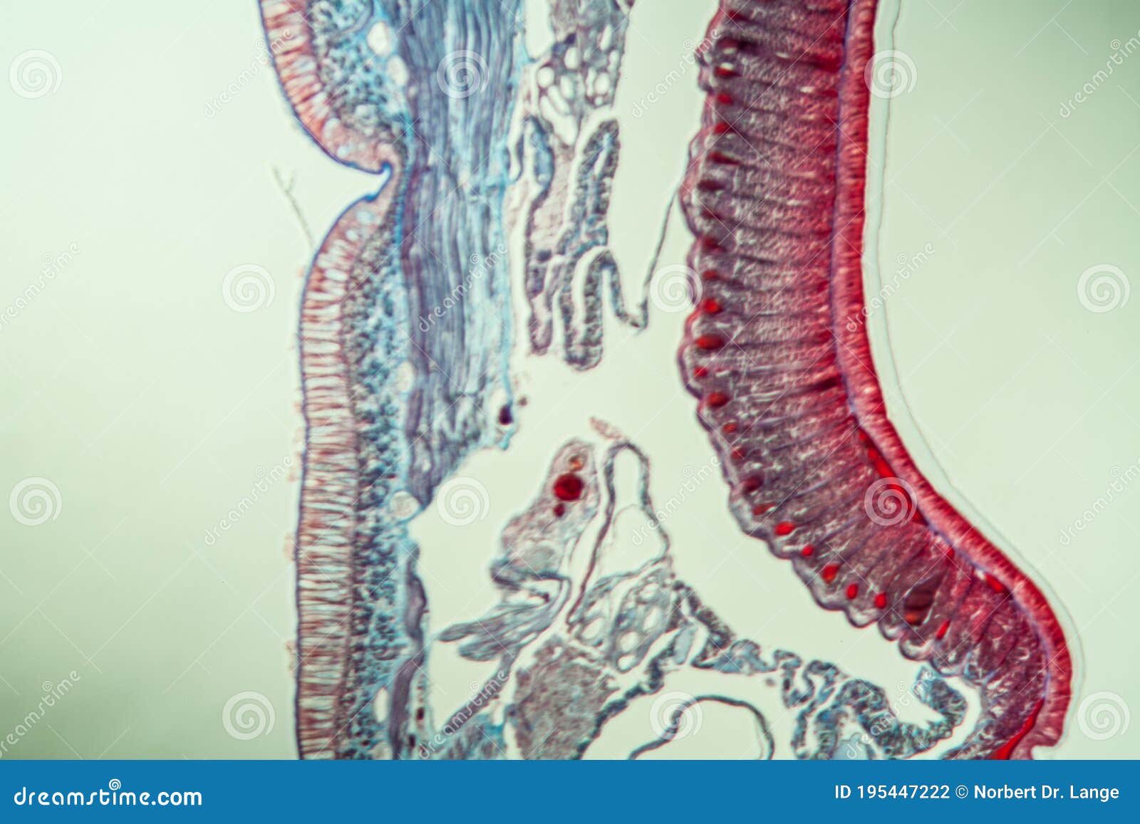 Earthworm Cross Section Segment 10