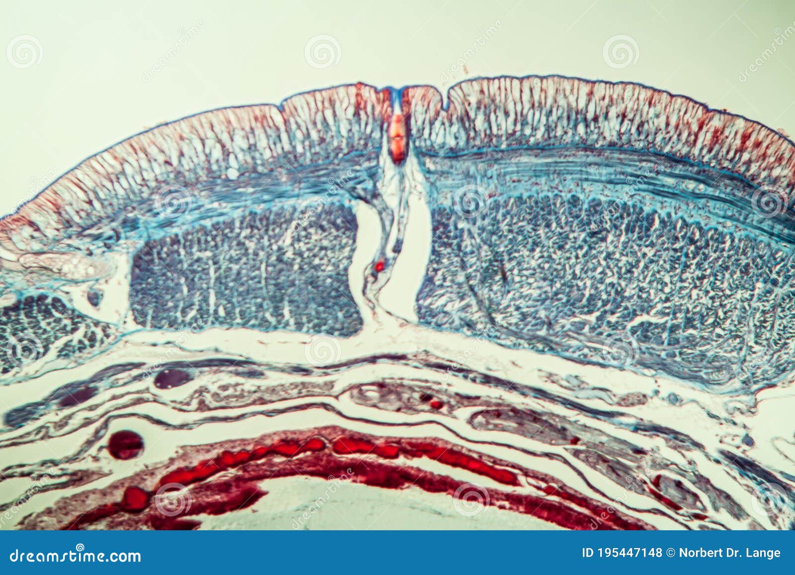 Earthworm Histology Cross Section 10th Segment Stock Photo - Image of ...