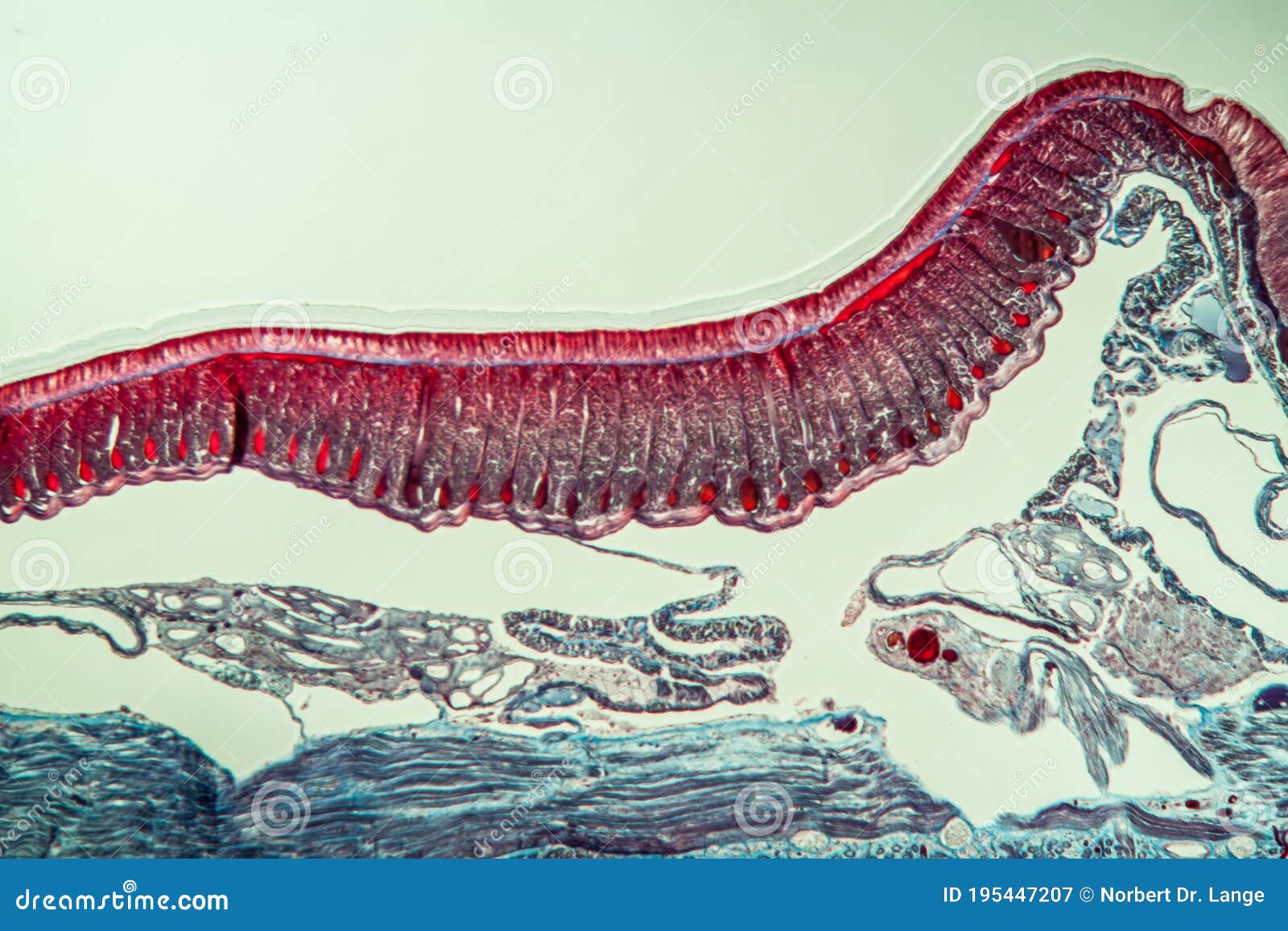 Earthworm Histology Cross Section 10th Segment Stock Image - Image of ...