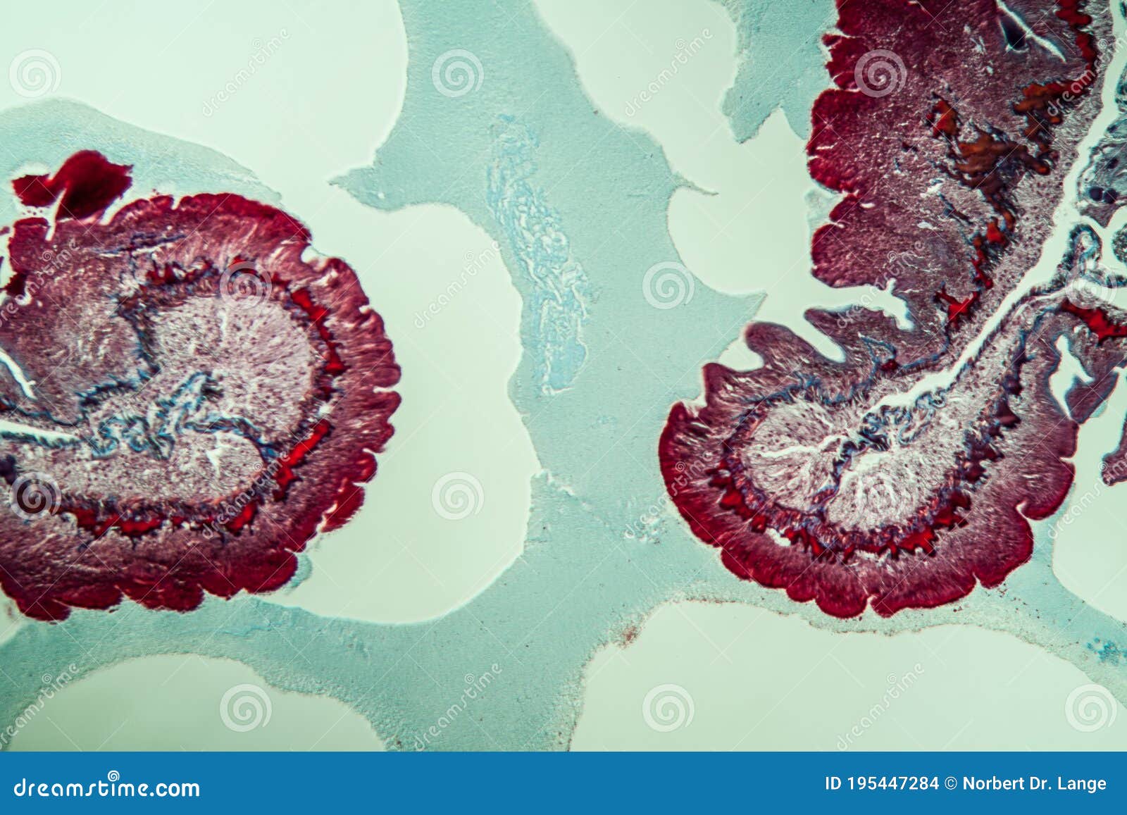 Earthworm Histology Cross Section 10th Segment Stock Photo - Image of ...