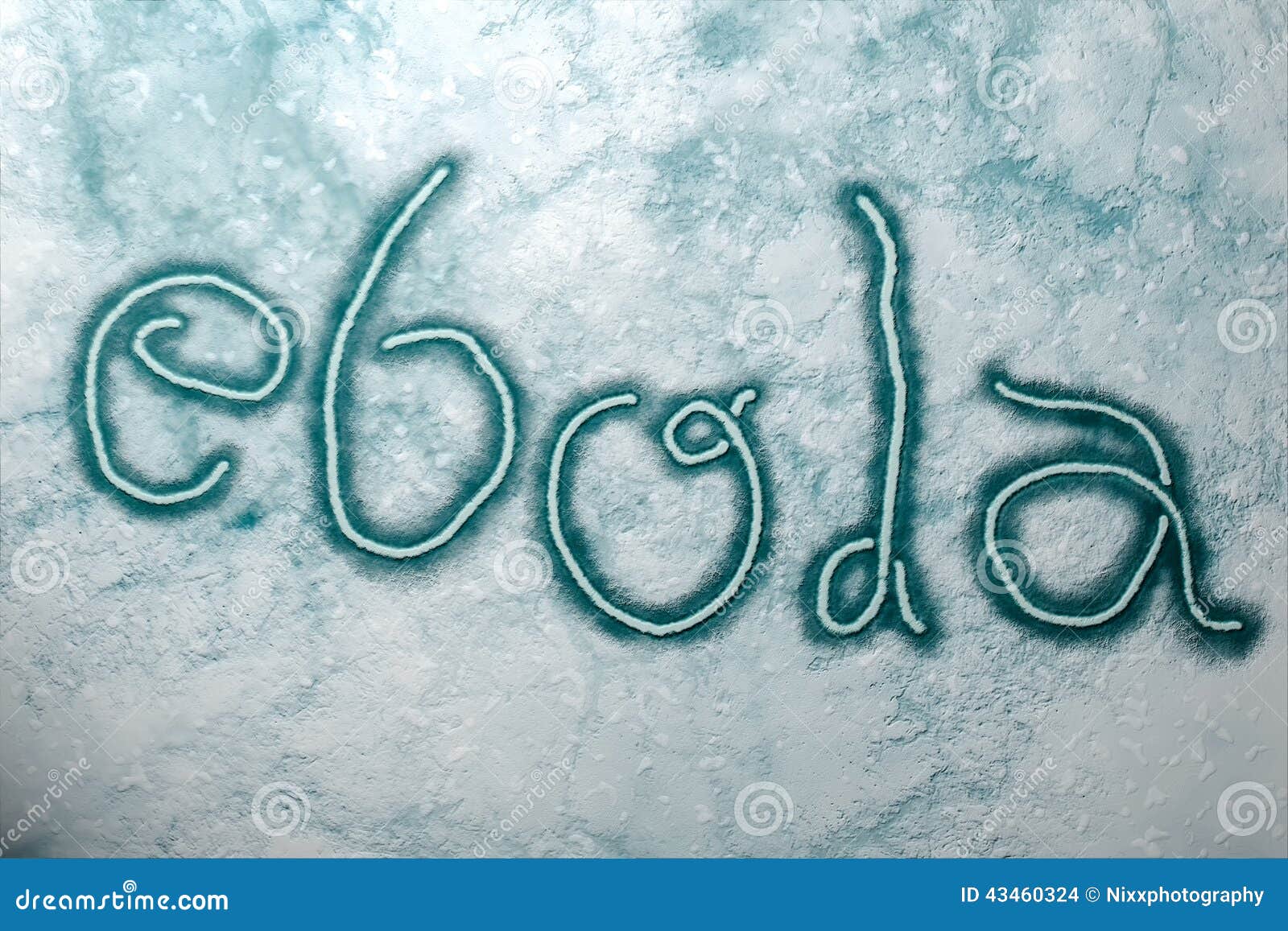 Hypovolemic Shock Pathology. Compensatory Mechanisms Of Hypovolemic ...