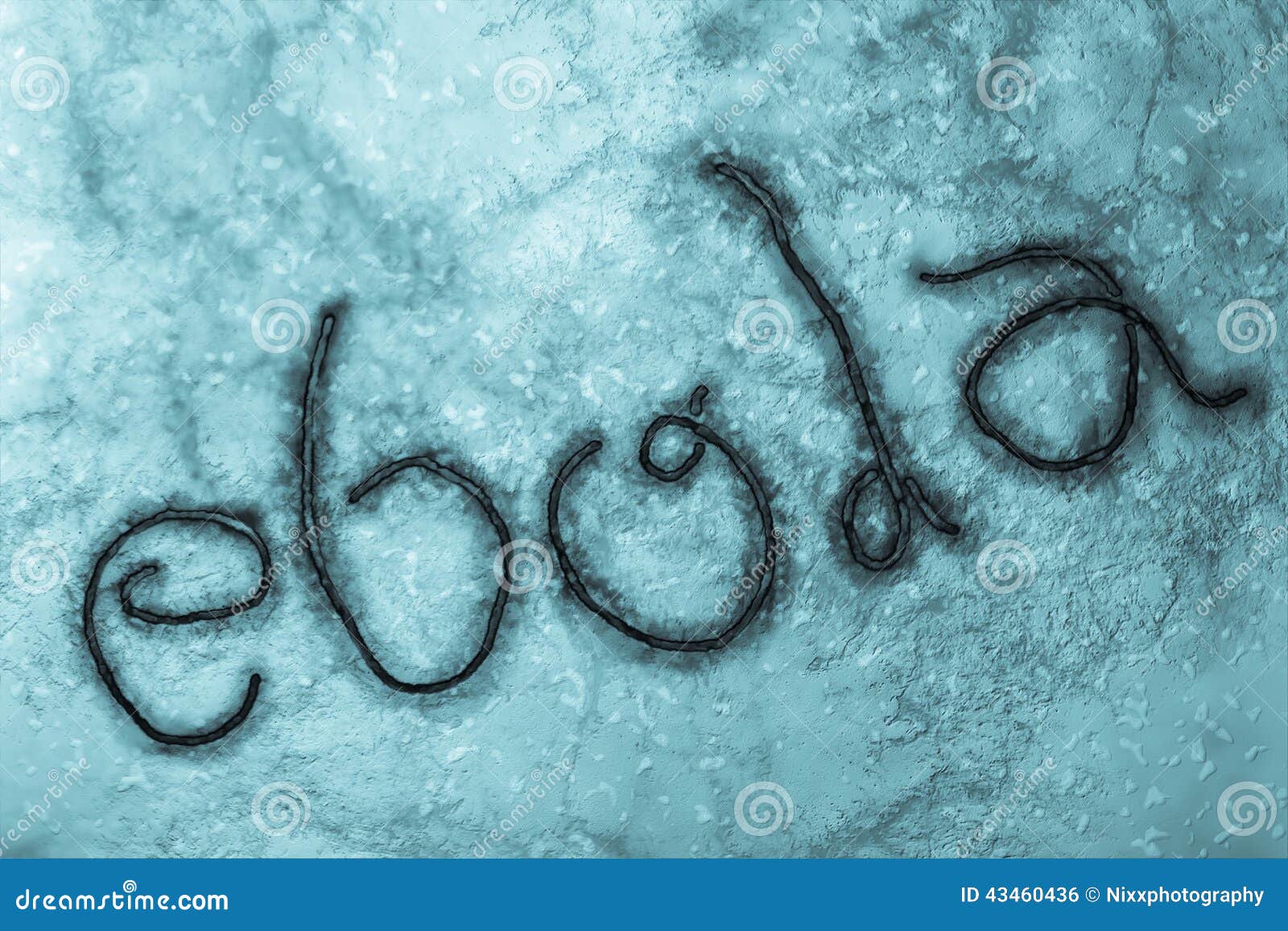 Hypovolemic Shock Pathology. Compensatory Mechanisms Of Hypovolemic ...