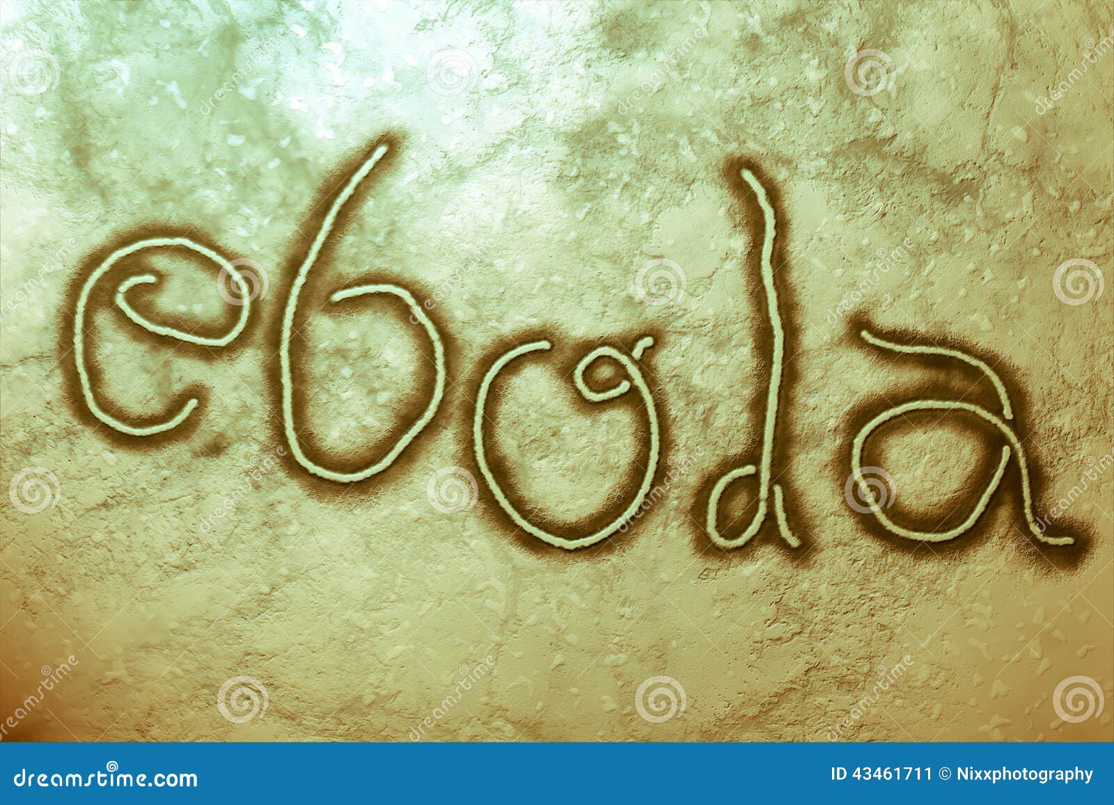 Hypovolemic Shock Pathology. Compensatory Mechanisms Of Hypovolemic ...