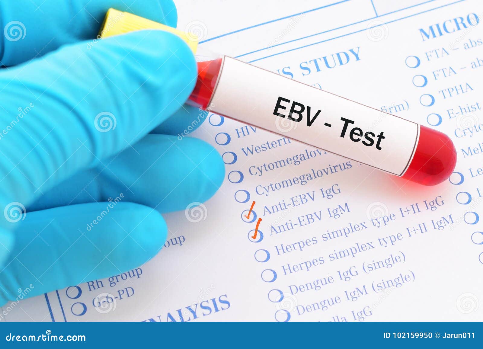 EBV test stock photo. Image of laboratory, hematology - 102159950