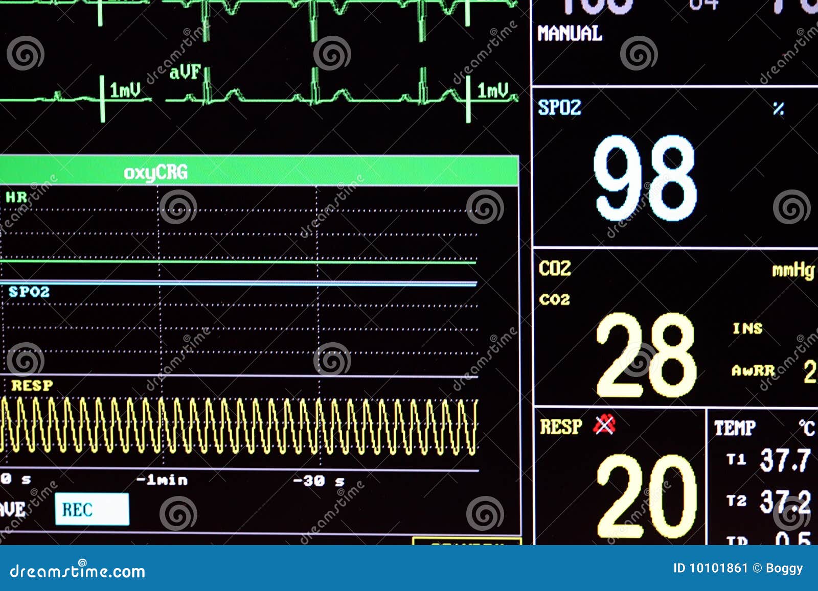 ECG stock image. Image of tool, modern, healthcare, electronics - 10101861